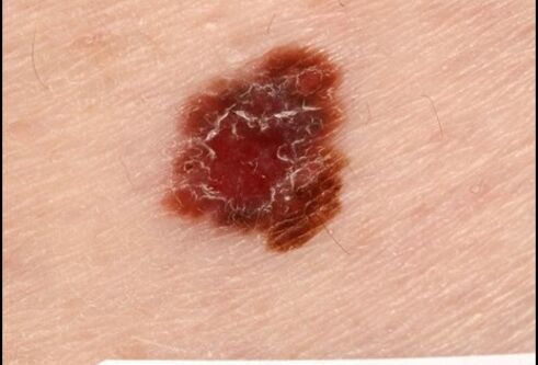 Professor Charlotte Proby | University of Dundee