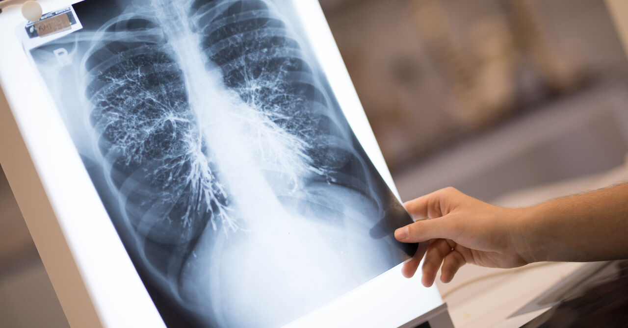 Anatomy and human identification research degrees | University of ...